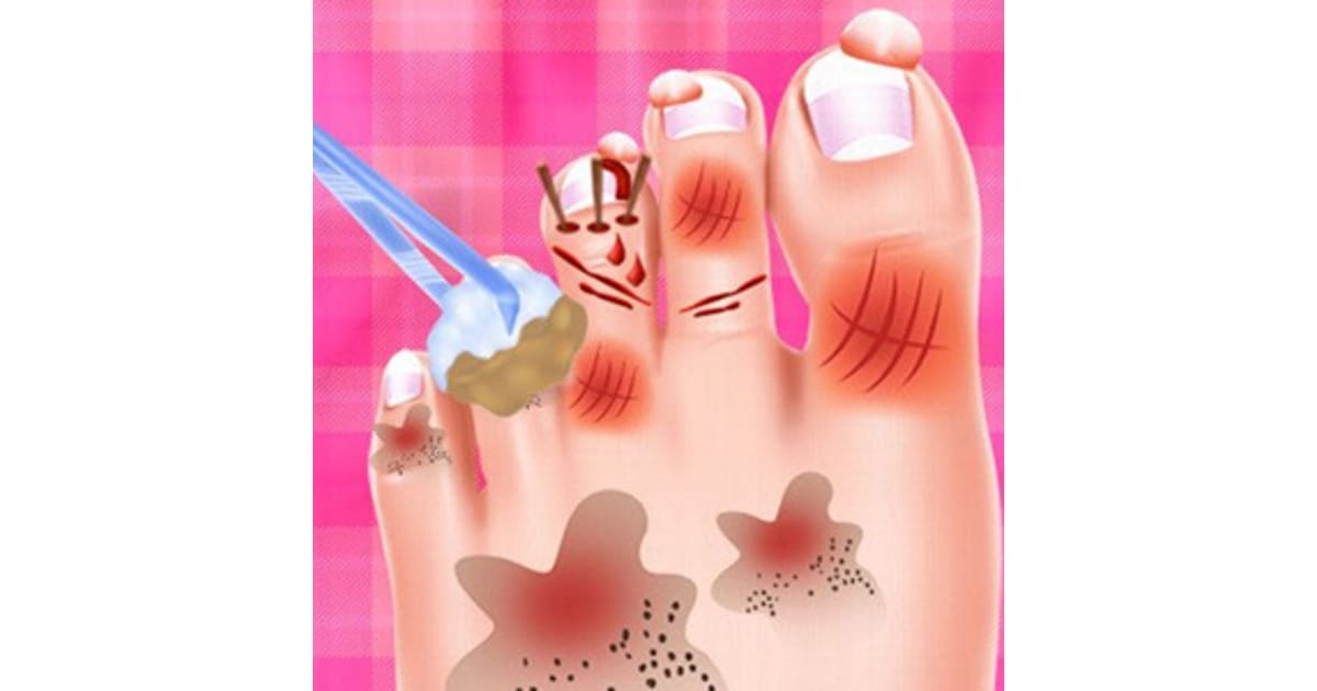 Baby Taylor Foot Treatment - Play Baby Taylor Foot Treatment Online at ...